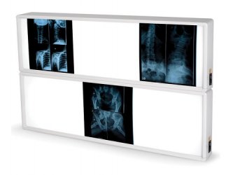 x-ray viewers UK - Medema